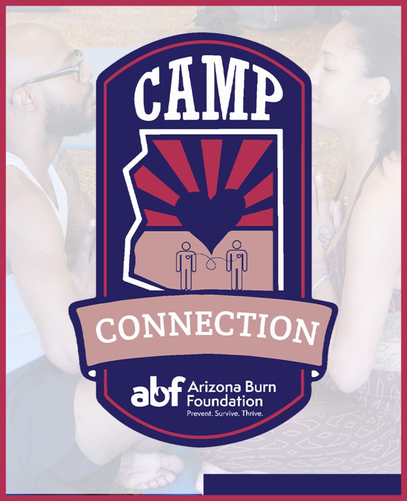 Camp Connection: A Powerful Weekend of Healing and Hope - Arizona Burn ...
